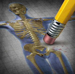 Shrinking Prevention: It’s all About Your Bone Health